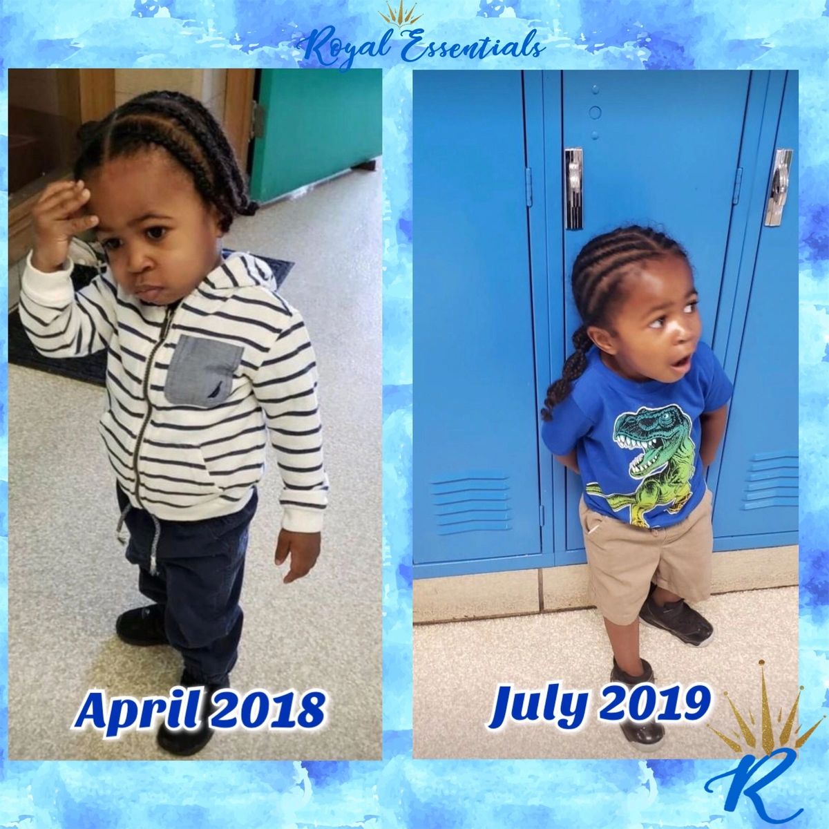 HAIR CARE BUNDLE DEAL #1 – Royal Essentials